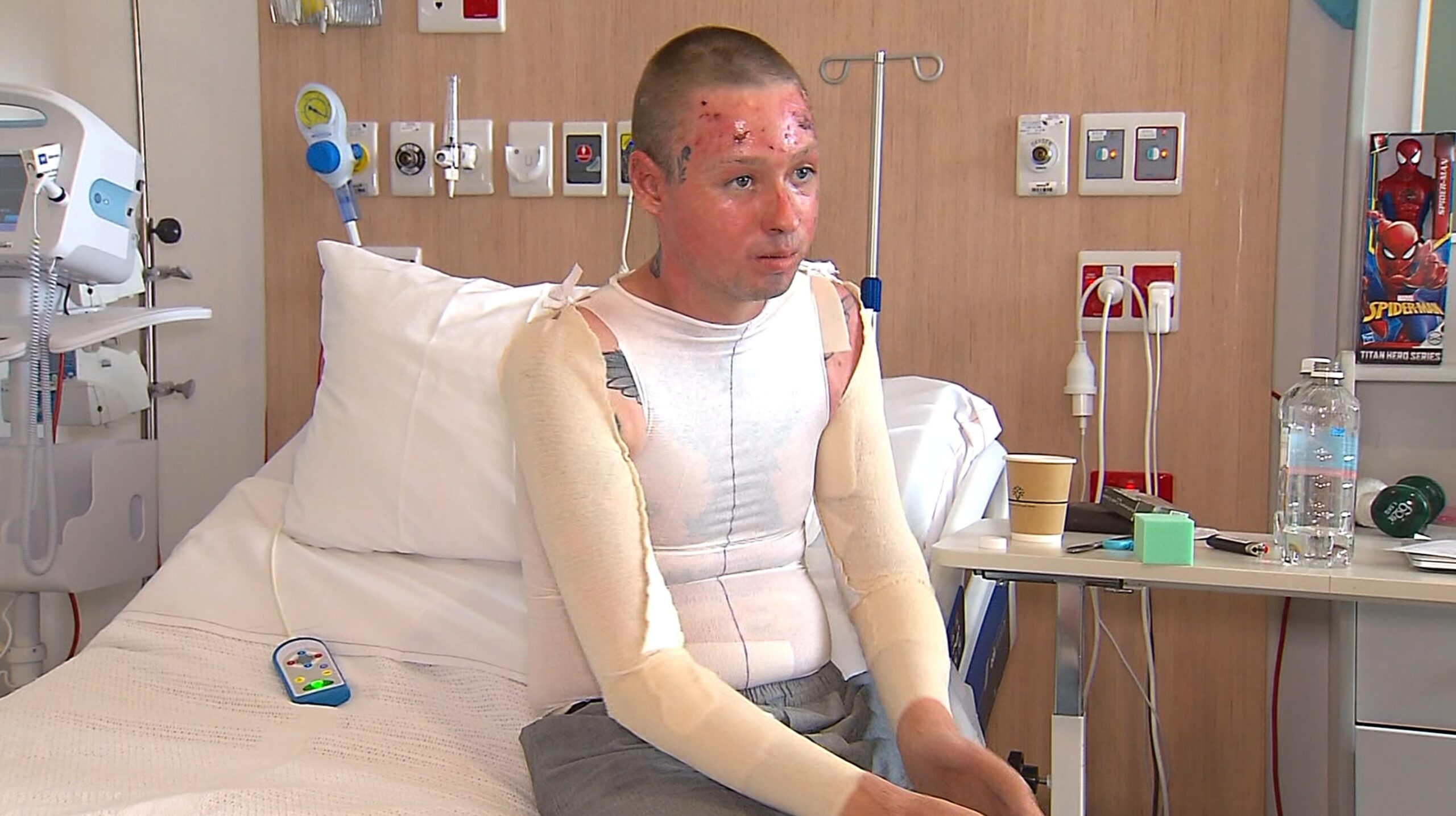 Survivor of alleged brutal Newcastle attack speaks out – NBN News