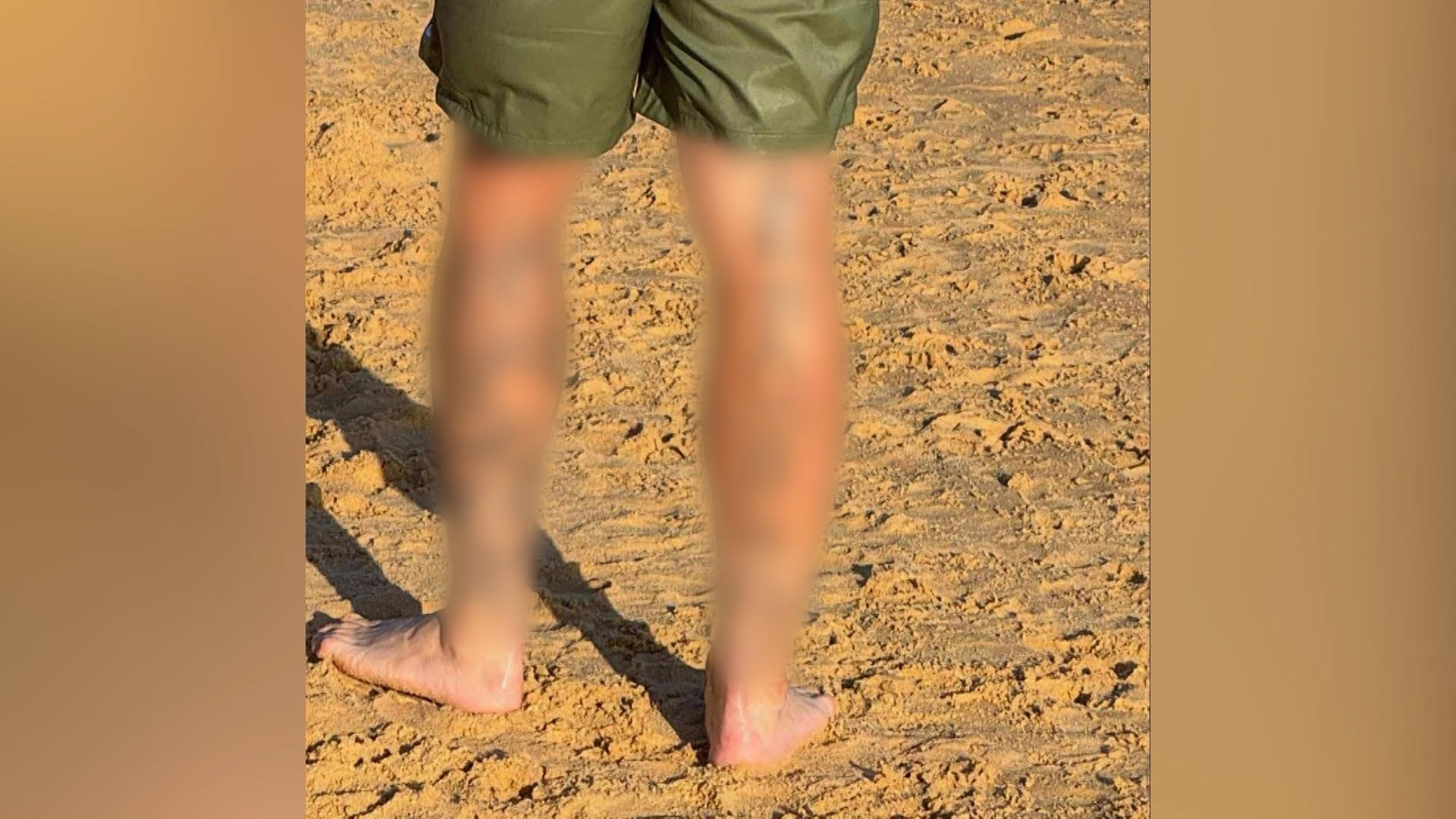 Man charged after allegedly displaying hate symbols at Newcastle beach ...